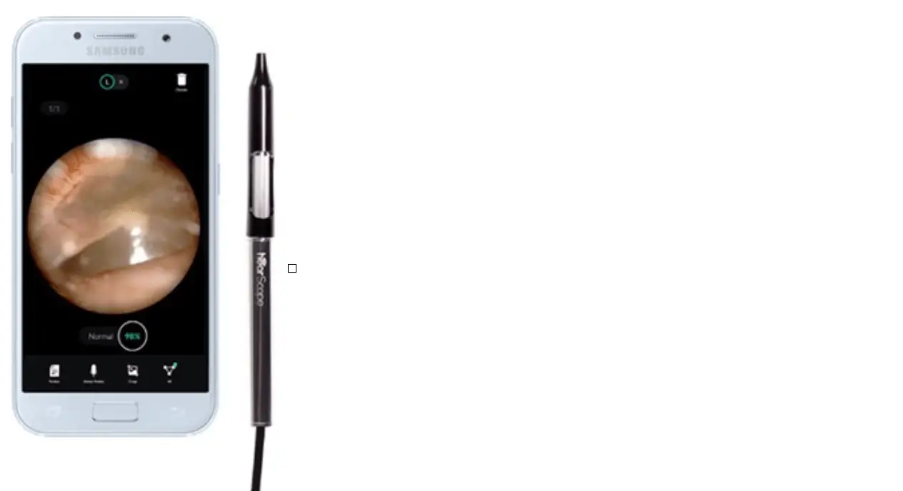 Artificial Intelligence and Otolaryngology. | Artificial Intelligence