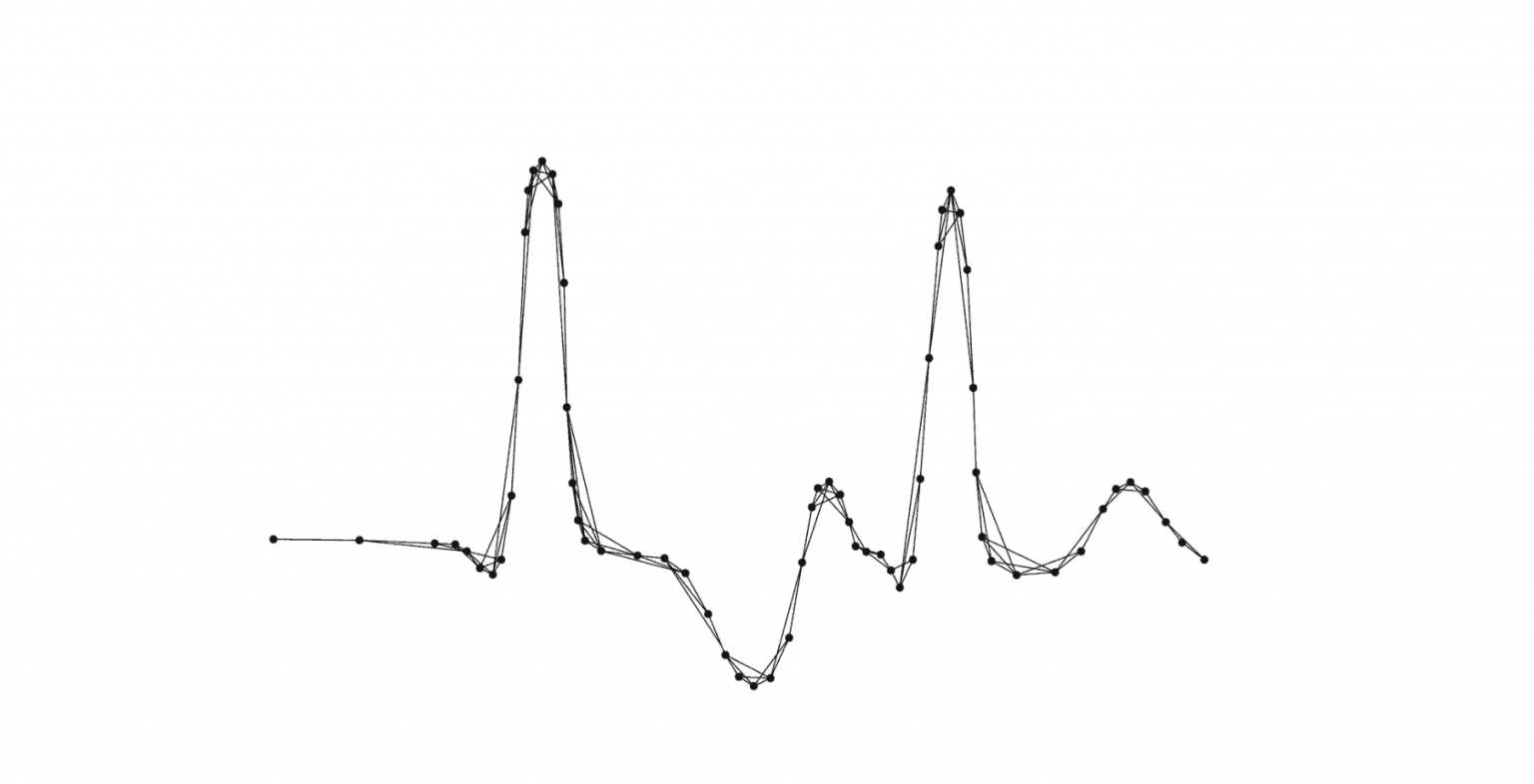 Overfitting Vs Underfitting In Machine Learning Algorithms Artificial Intelligence